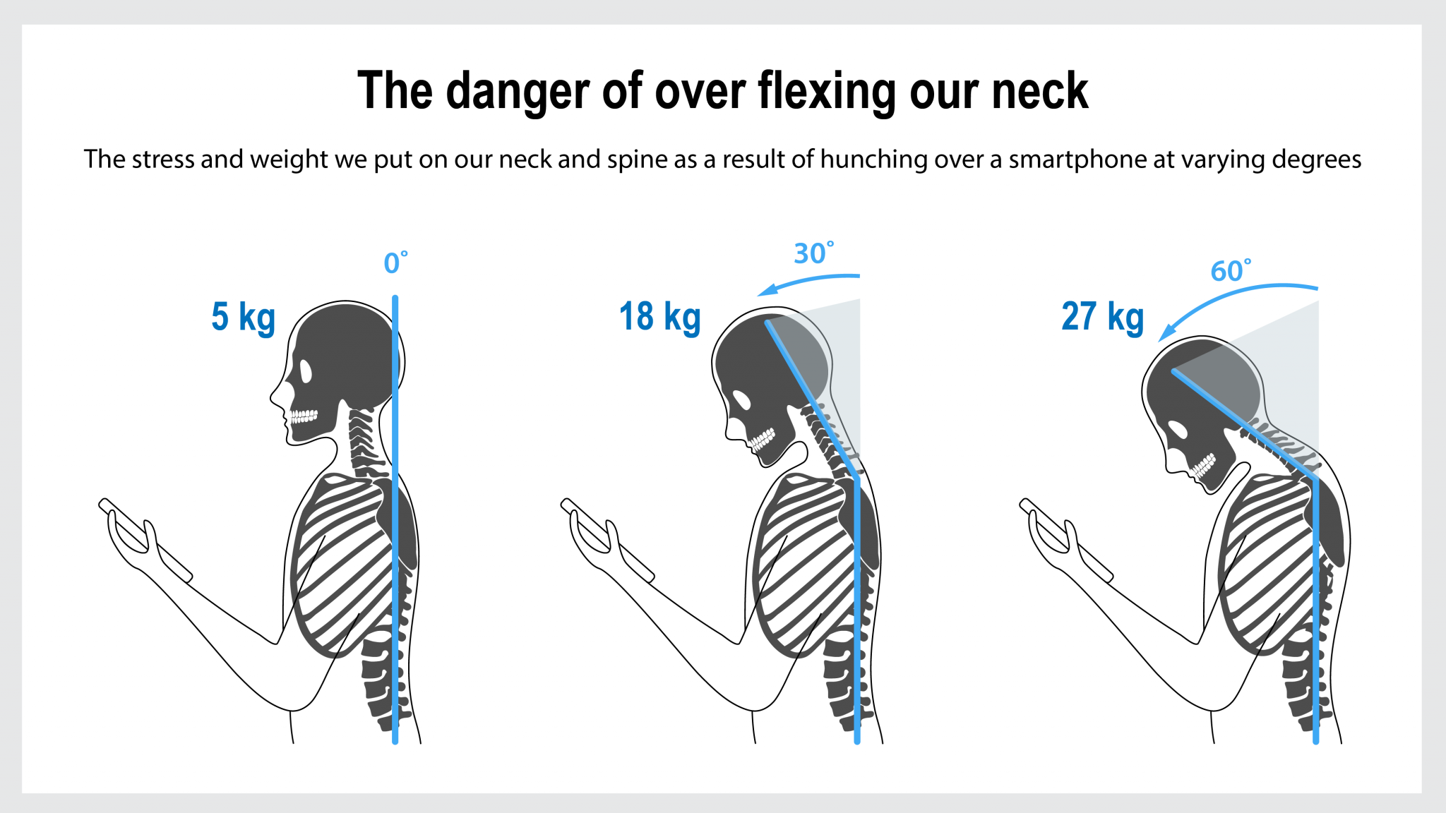 Text Neck Syndrome – Are you suffering from one? - Mediconnexions